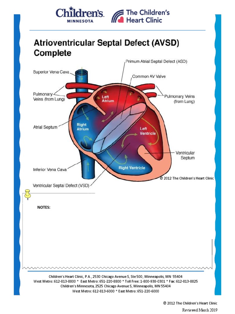 Atrioventricular-Septal-Defect-Avsd-Complete Edit | PDF | Heart Valve ...