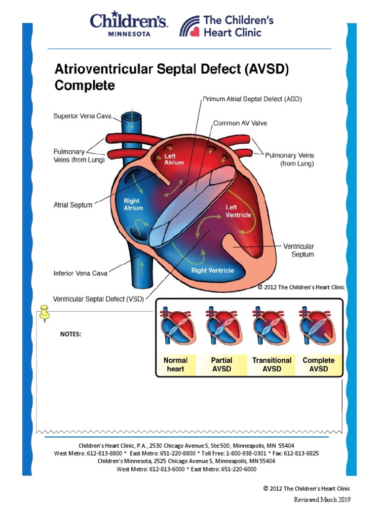 Atrioventricular Septal Defect Avsd Complete | PDF | Heart Valve | Congenital Heart Defect
