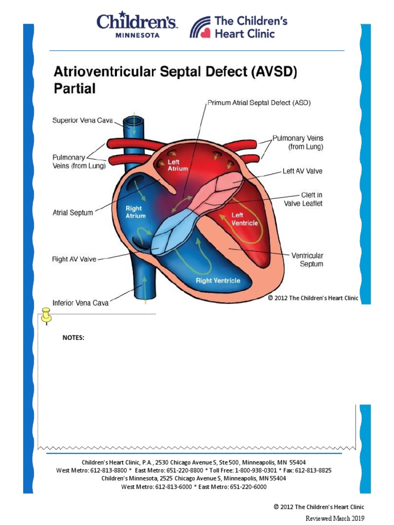 Atrioventricular Spetal Defect Avsd Partial Edit | PDF | Congenital Heart Defect | Heart Valve