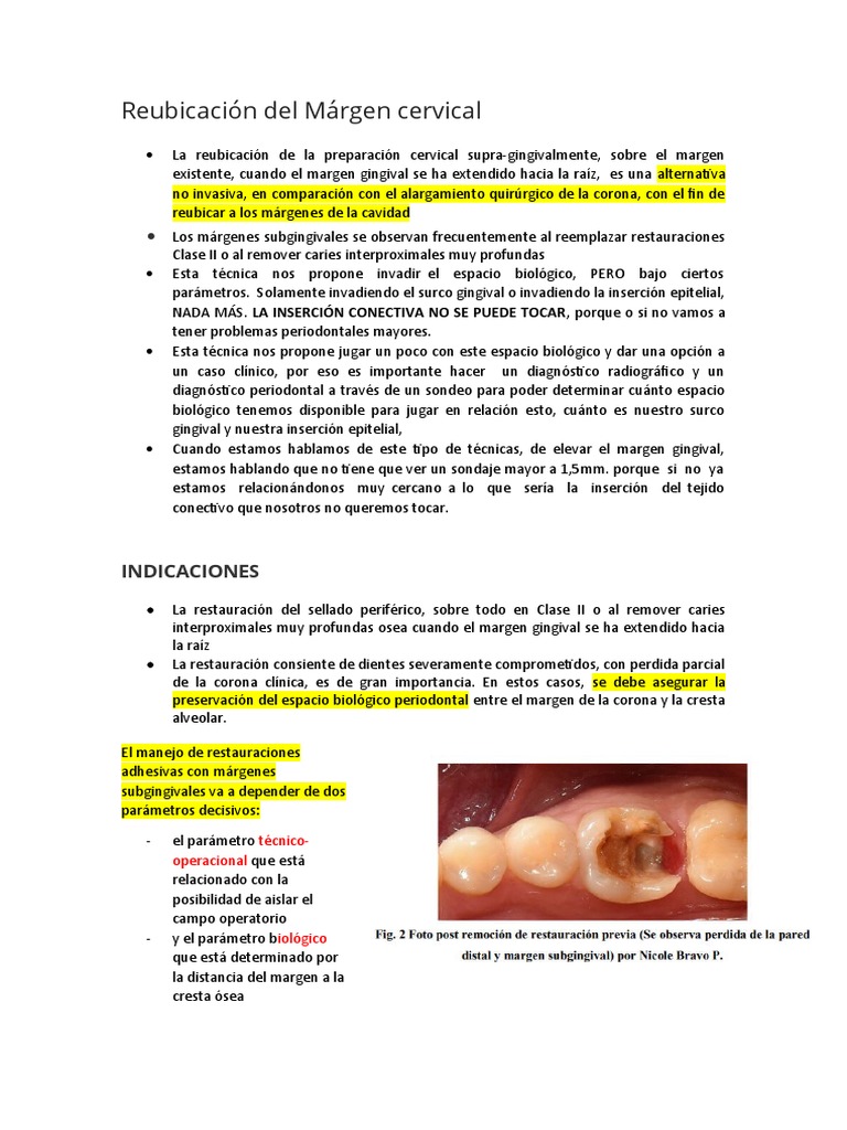 Reubicación del Margen Cervical Dental | PDF | Ciencias de la Salud | Boca