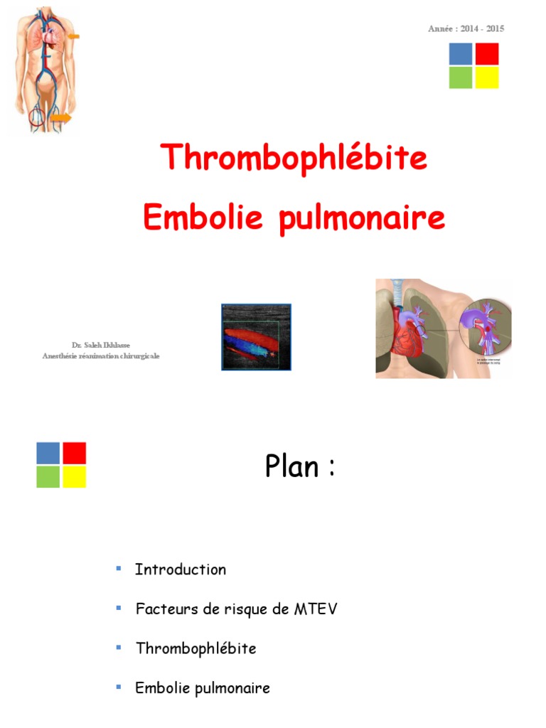 Thrombophlébite et embolie pulmonaire | PDF | Maladies et troubles ...