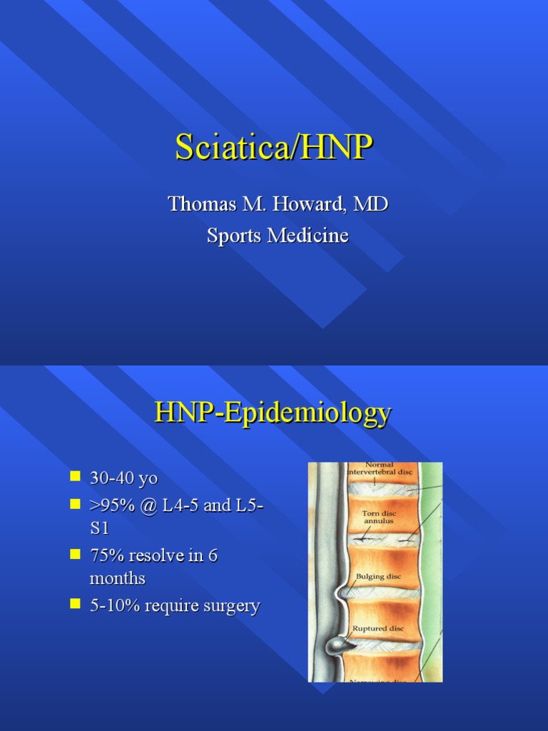 Sciatica | PDF | Medical Specialties | Diseases And Disorders