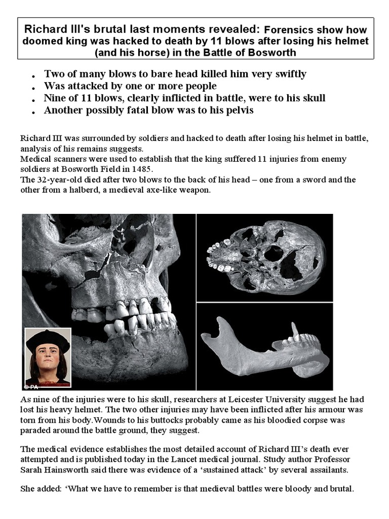 Richard III's Brutal Last Moments Revealed | PDF | Richard Iii Of England