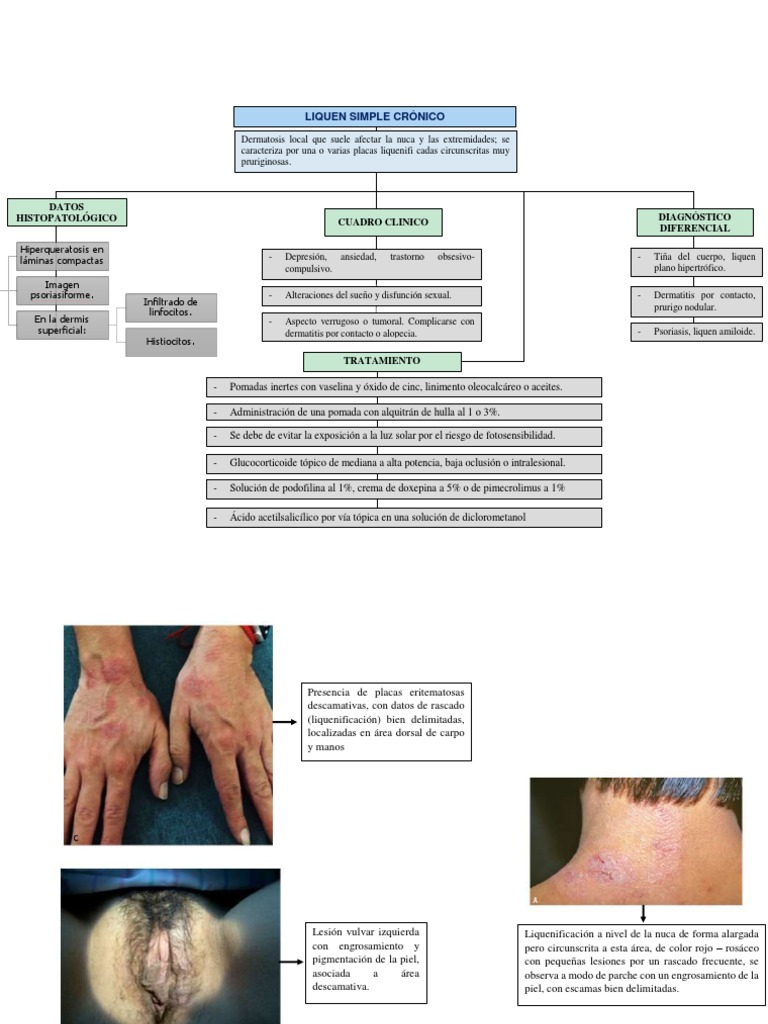 Liquen Simple Crónico | PDF | Medicina CLINICA | Ciencias de la Salud