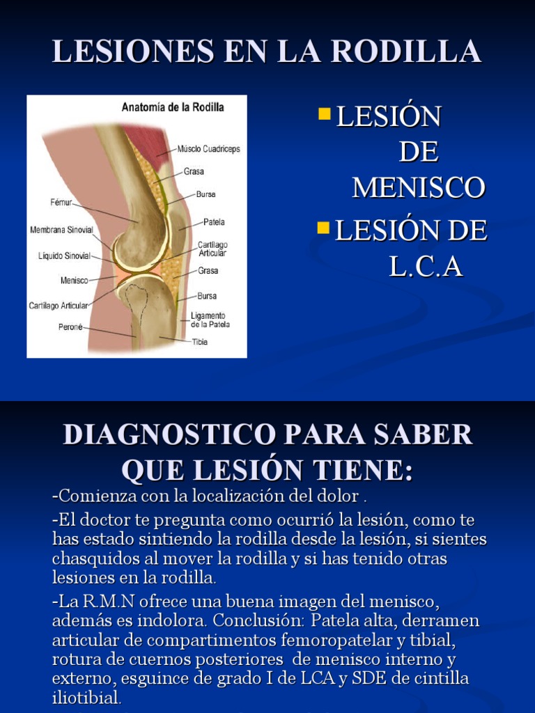 Lesiones de Rodilla: Menisco y LCA | PDF | Rodilla | Extremidades ...