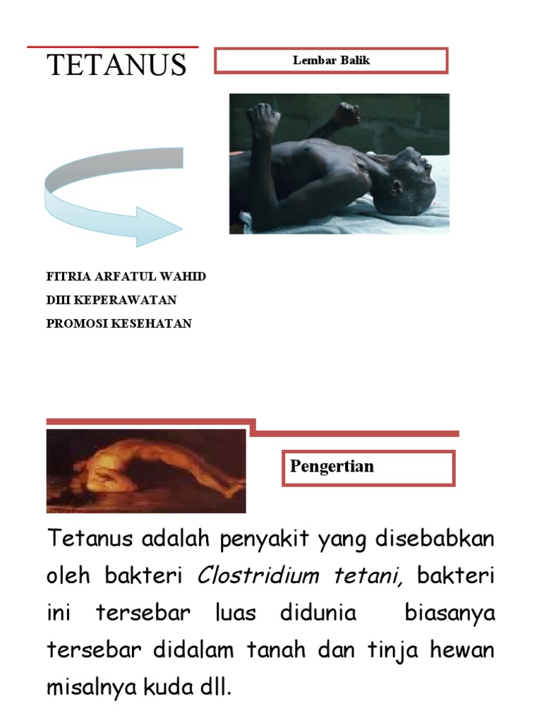 Gejala dan Penanganan Tetanus | PDF | Kesehatan Holistik