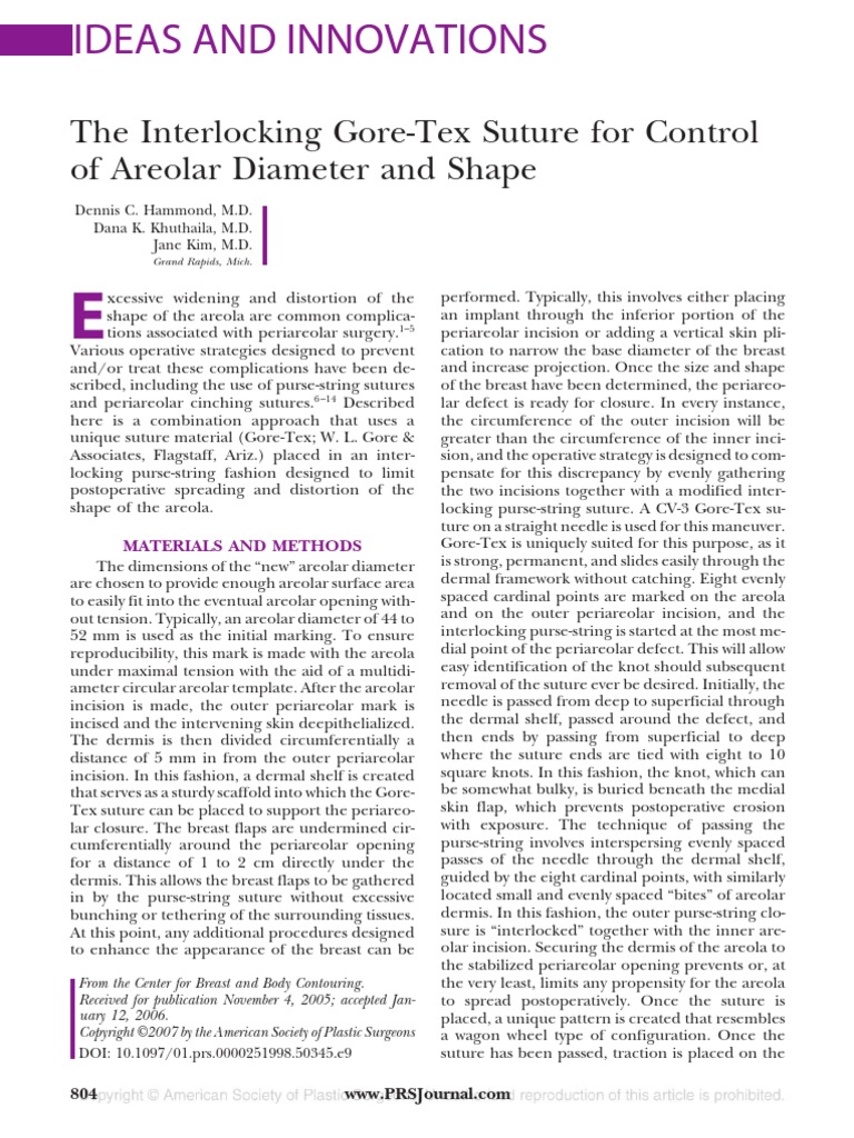 The Interlocking Gore Tex Suture For Control Of.5 | PDF | Cosmetic ...