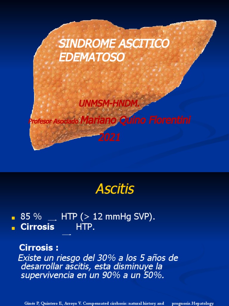 T8.2. SX Ascitico Edematoso | PDF | Medicina CLINICA | Órgano (anatomía)