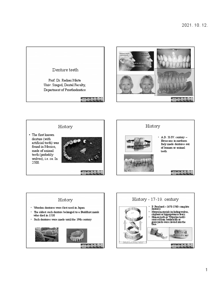 Denture Teeth: Prof. Dr. Radnai Márta Univ. Szeged, Dental Faculty ...