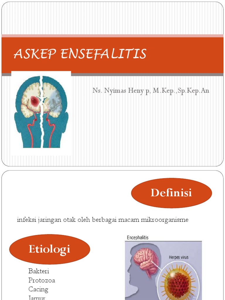 Askep Anak DG Ensefalitis+ppt | PDF