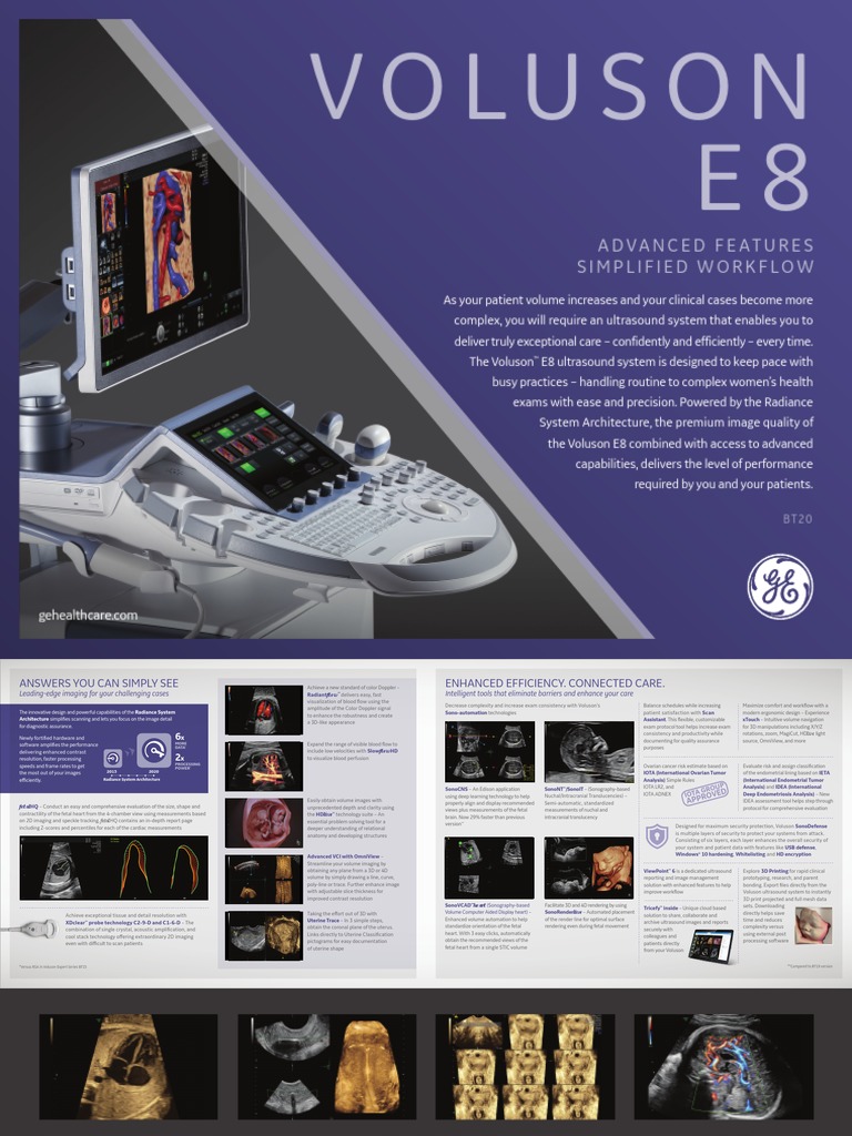 Voluson E8: Advanced Features Simplified Workflow | PDF | Medical ...
