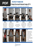 Epley Maneuver Instructions for Left Ear | PDF | Physical Therapy