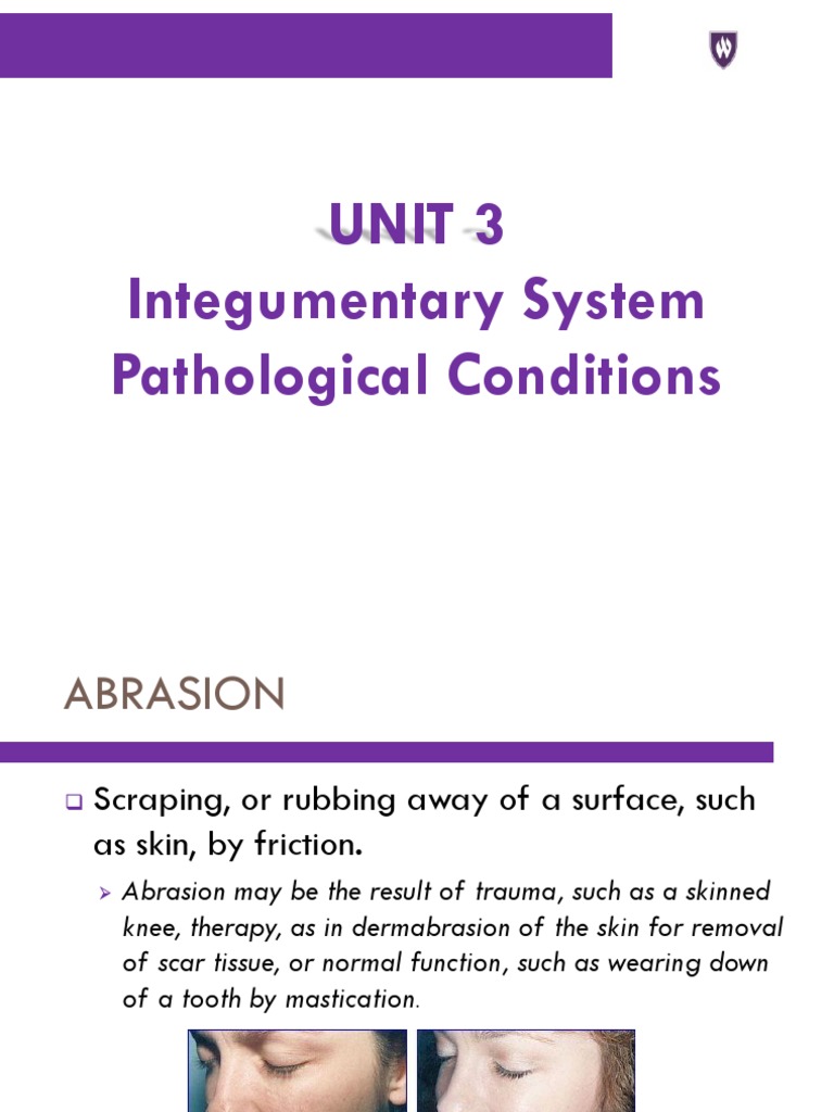 Unit 3 Integumentary System Pathological Conditions | PDF | Biopsy ...