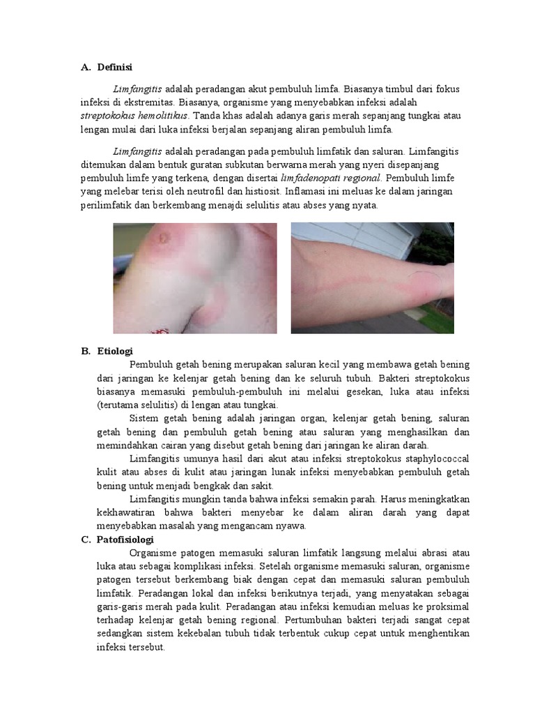 Penyebab dan Tatalaksana Limfangitis | PDF