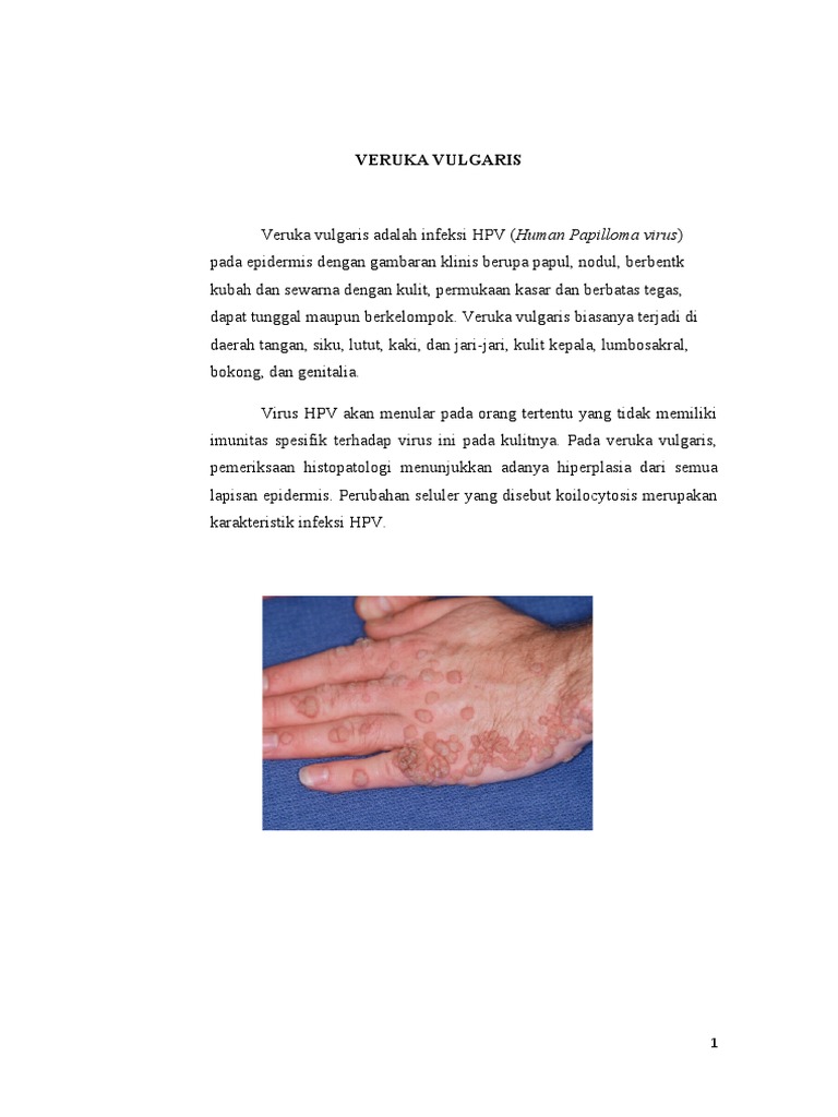 Veruka Vulgaris | PDF