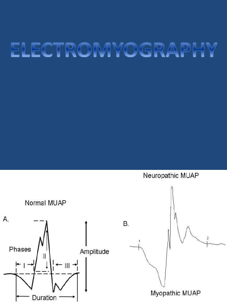 Electromyography | PDF | Electromyography | Neuroscience