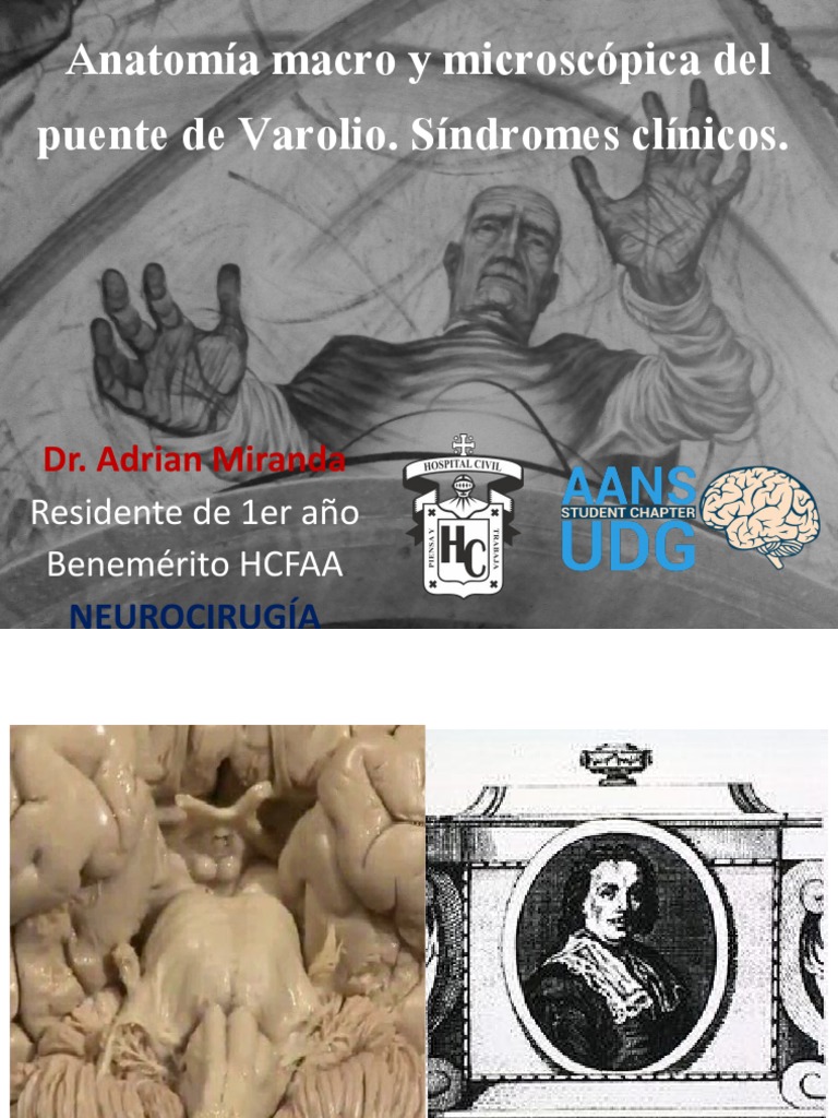 Anatomía y síndromes del puente de Varolio | PDF | Anatomía humana ...