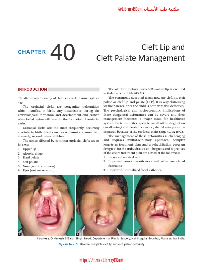 Cleft Lip | PDF | Human Nose | Facial Features