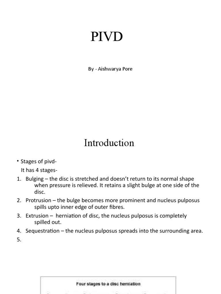 PIVD Stages and Treatment | PDF | Vertebral Column | Back Pain