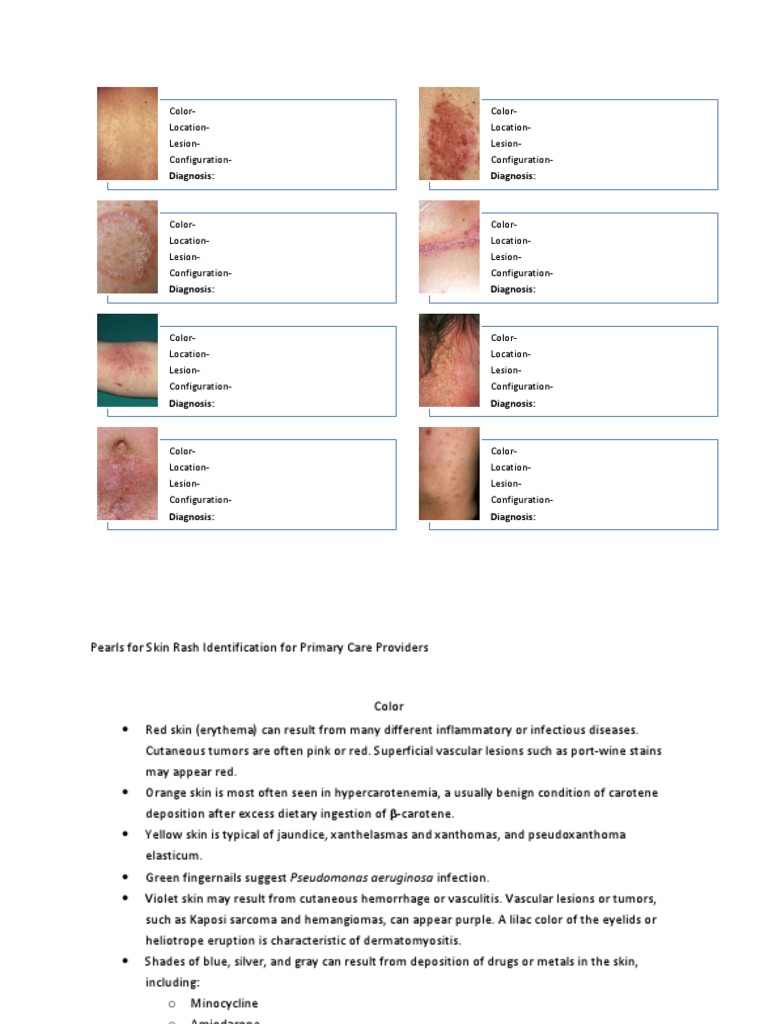 Skin Rash Station Worksheet and Handout | PDF | Dermatitis | Psoriasis