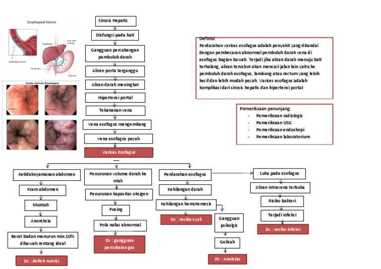 Pathway Varises Esofagus | PDF