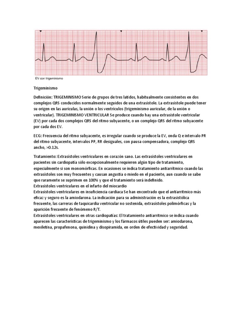 Trigeminismo Ventricular: Definición y Tratamiento | PDF