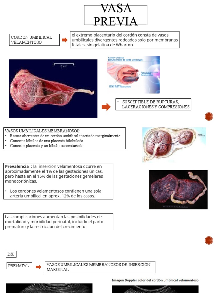 Vasa Previa | PDF | Placenta | El embarazo