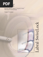 FiberStitch™ Meniscal Repair Technique | PDF | Surgical Suture ...