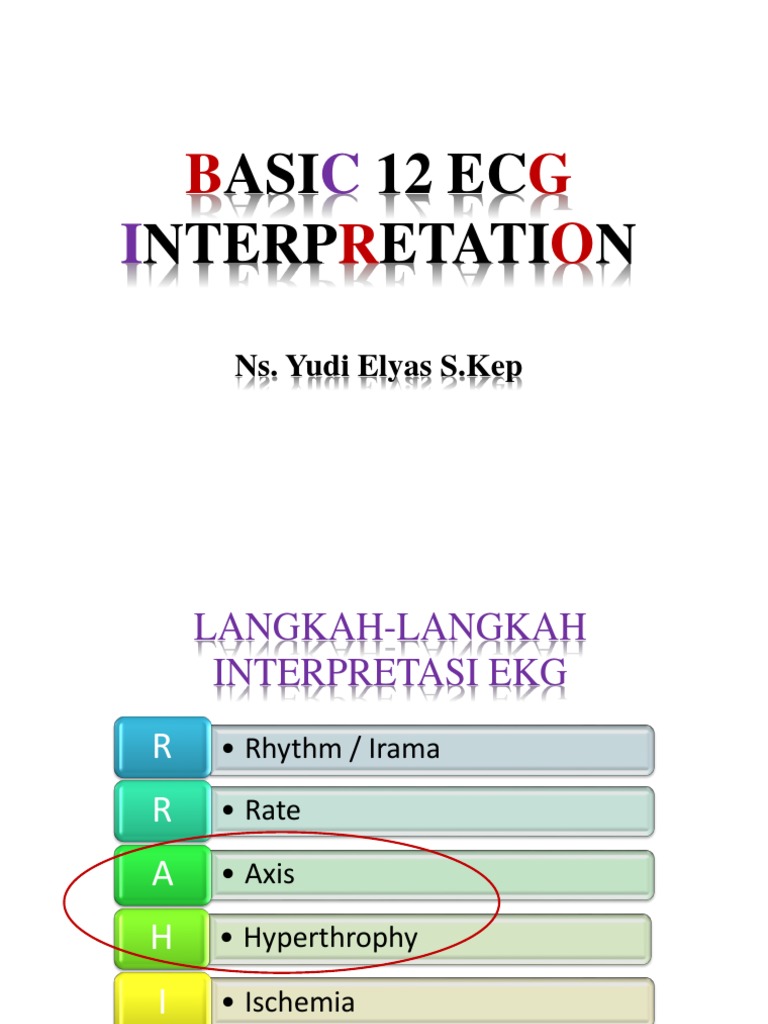 12 Leads ECG Interpretation | PDF