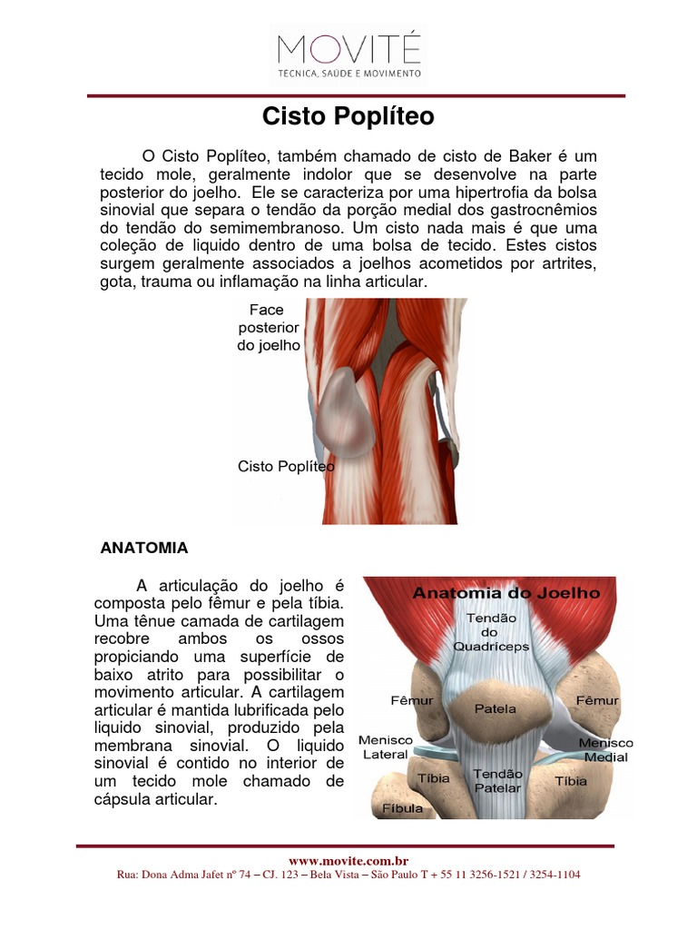 Cisto Poplíteo | PDF | Edema | Joelho