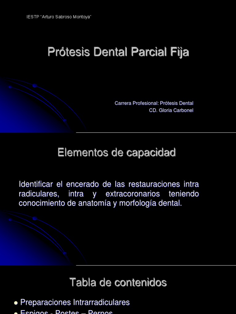 Restauraciones intrarradiculares: tipos de espigos, postes y pernos ...