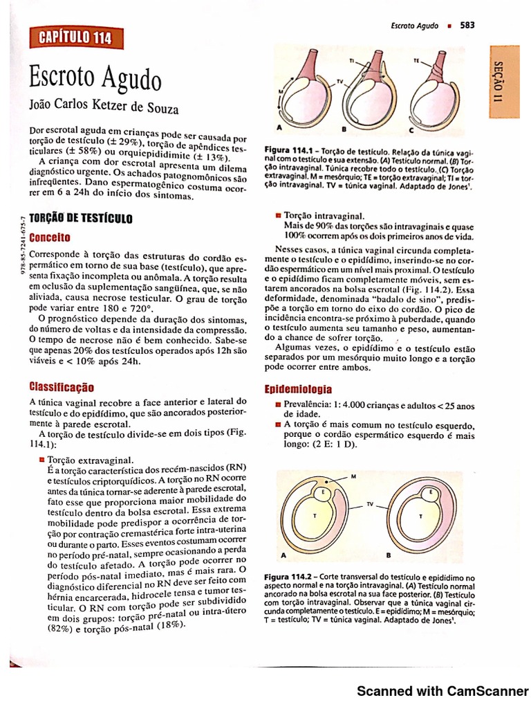 Escroto Agudo | PDF
