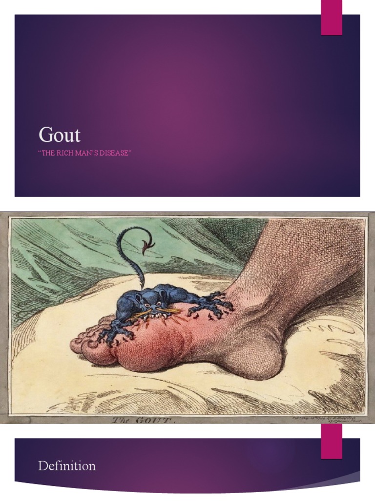 The Rich Man'S Disease | PDF | Gout | Medical Specialties