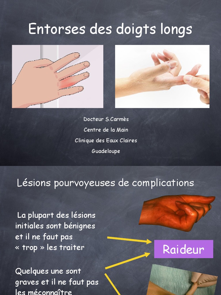 Entorses des doigts longs : diagnostic et traitement | PDF | Main ...