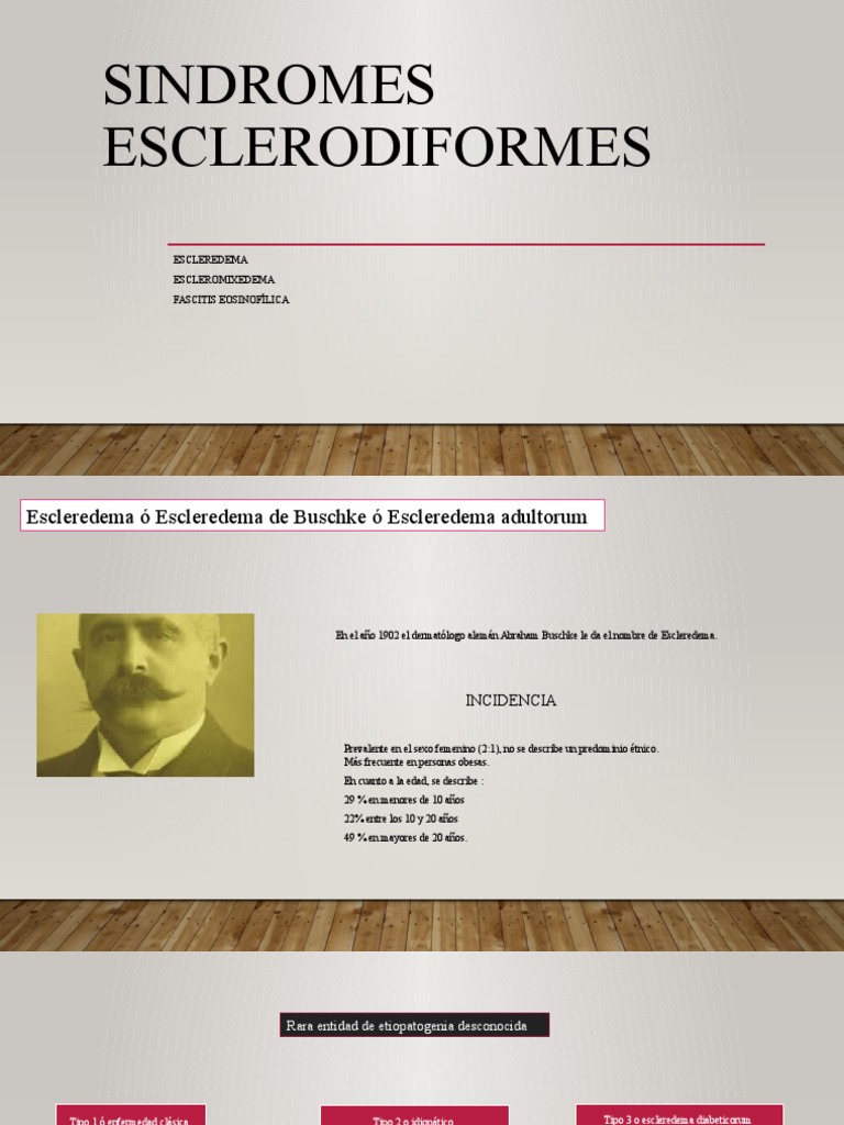 Sindromes Esclerodiformes: Escleredema Escleromixedema Fascitis ...