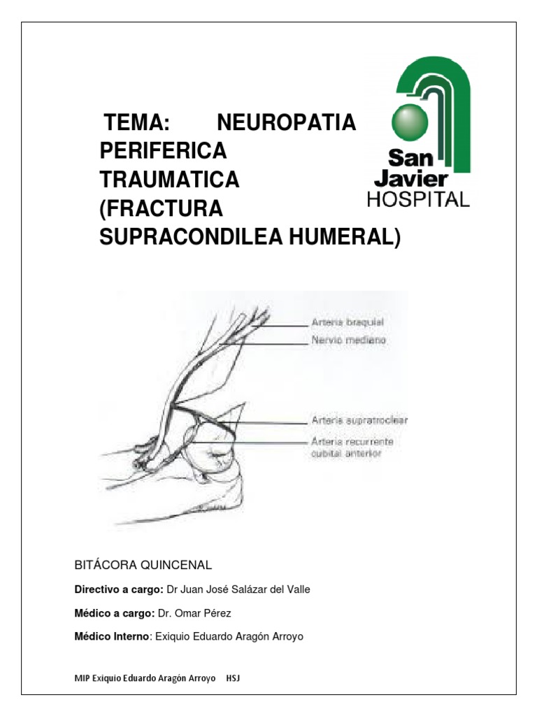 Neuropatía Periférica Traumatica en Fractura | PDF | Mielina | Axon