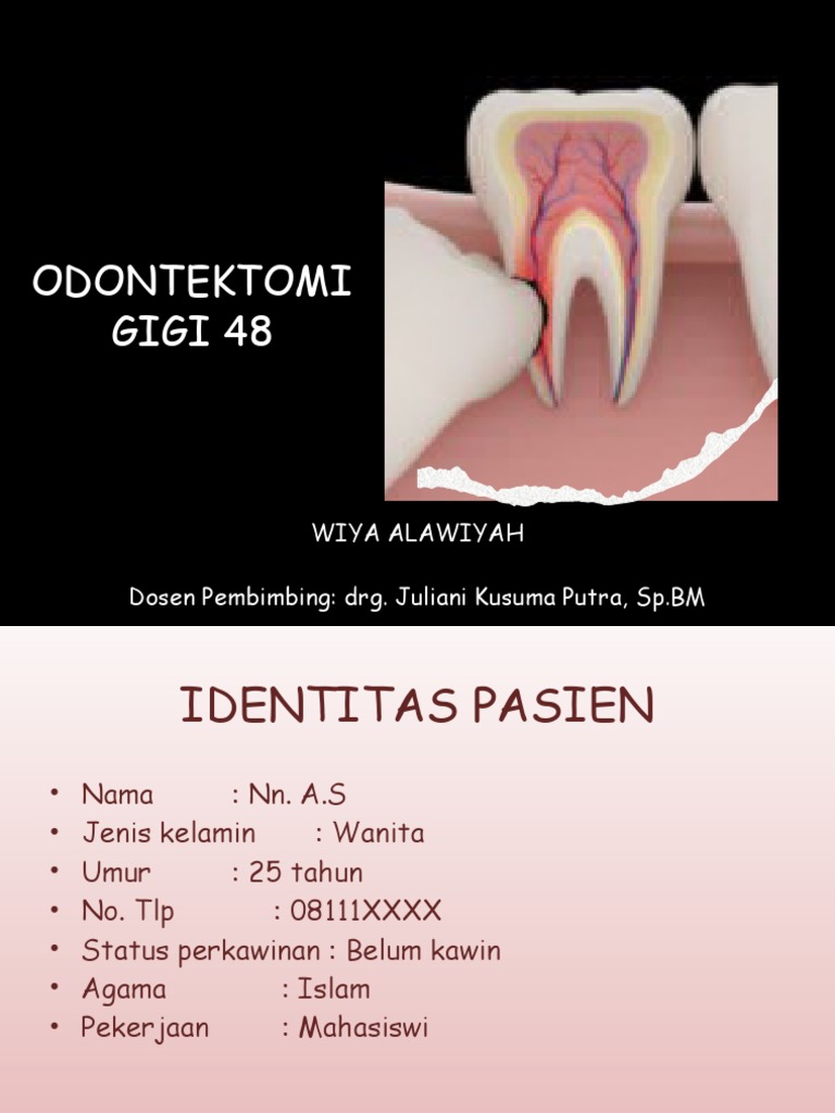 Impaksi Gigi 48 (Odontektomi Gigi 48) | PDF