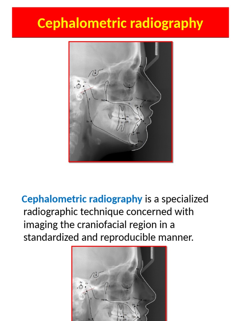 Cephalometric | PDF | Orthodontics | Skull