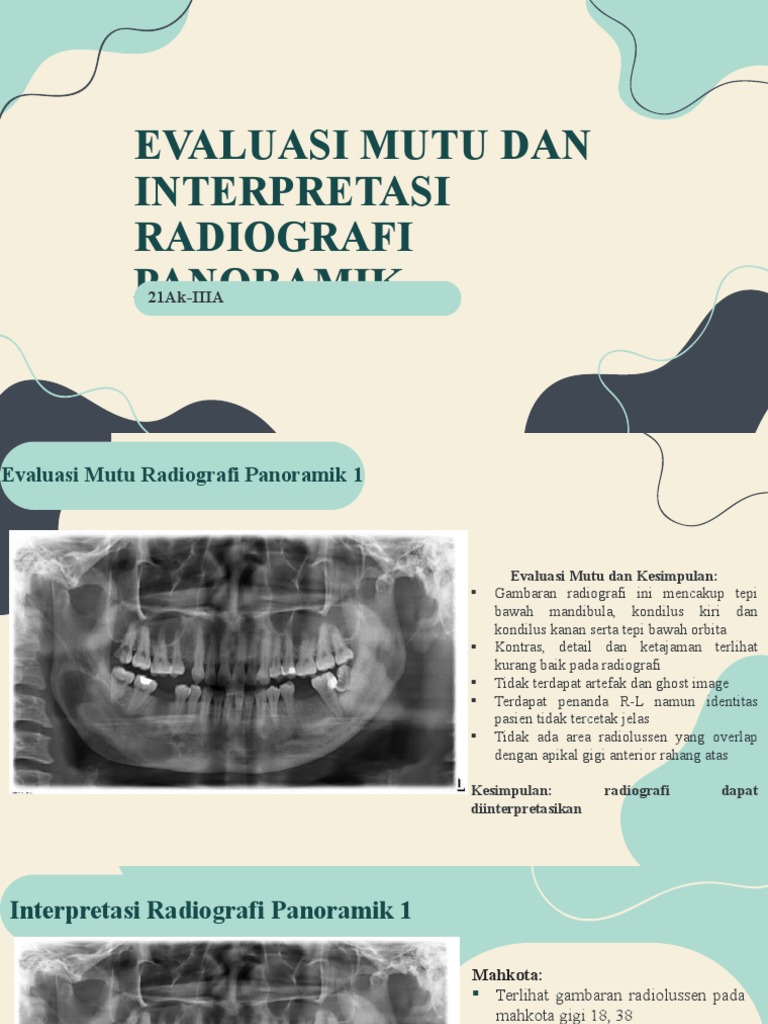 Evaluasi Mutu Dan Interpretasi Radiografi Panoramik | PDF