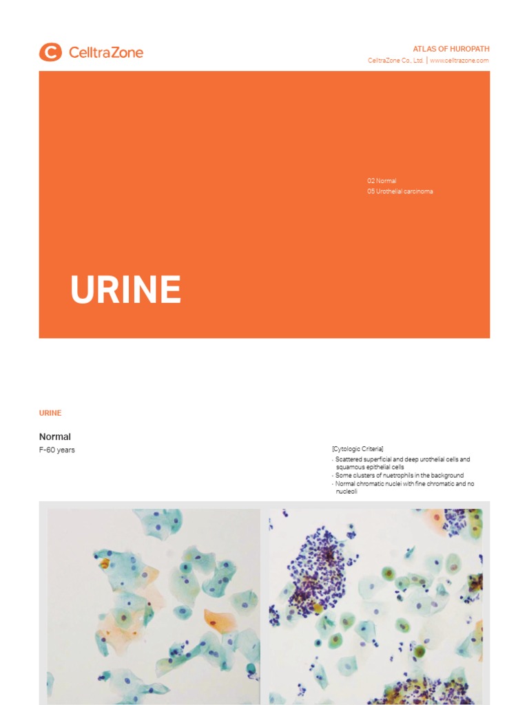 7 - HUROPATH Atlas URINE - 2106 | PDF | Cell Nucleus | Epithelium