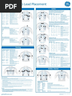 12 Lead EKG Limb/Chest Lead Placement Guide | PDF