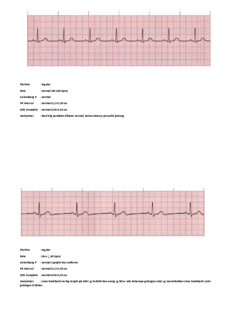 Soal Latihan Lab EKG - Kharisma | PDF