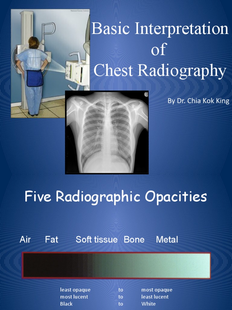 Basic Interpretation of CXR | PDF | Lung | Thorax
