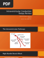 Understanding Left Anterior Fascicular Block | PDF | Circulatory System ...