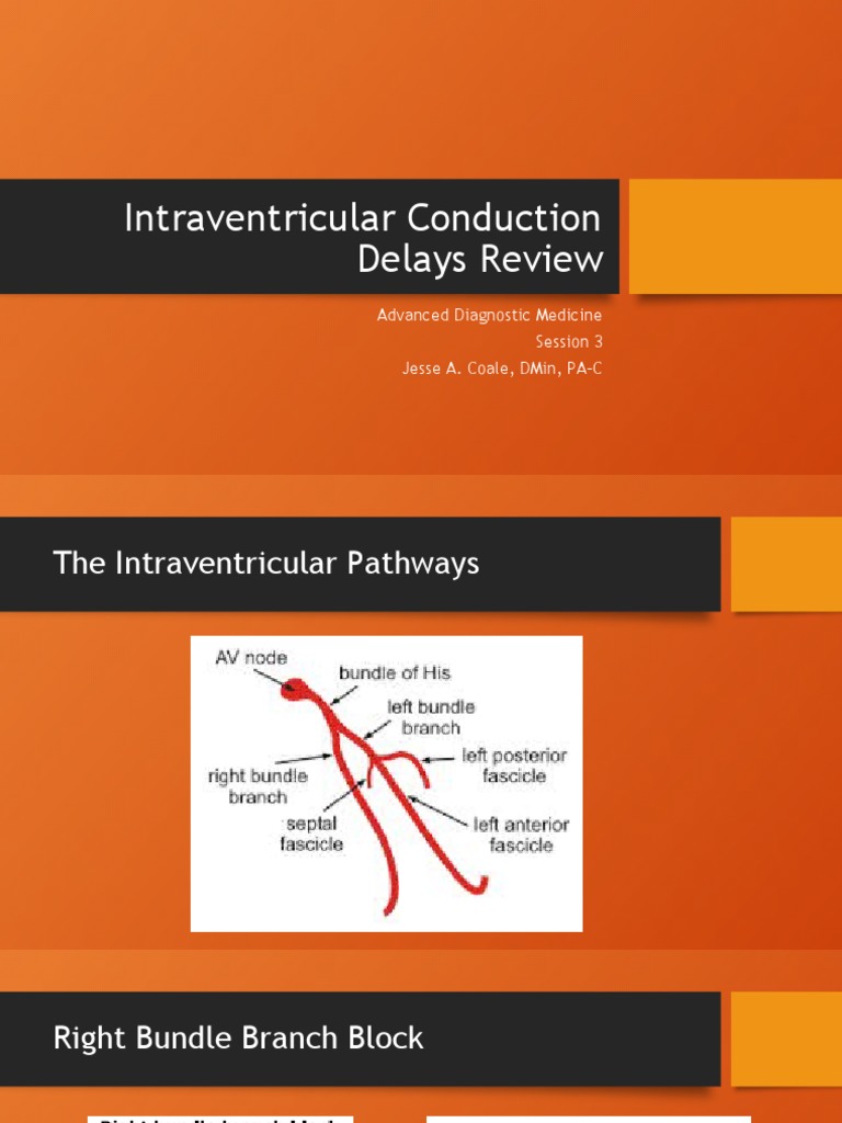 Intraventricular Conduction Delays Review | PDF | Electrocardiography ...