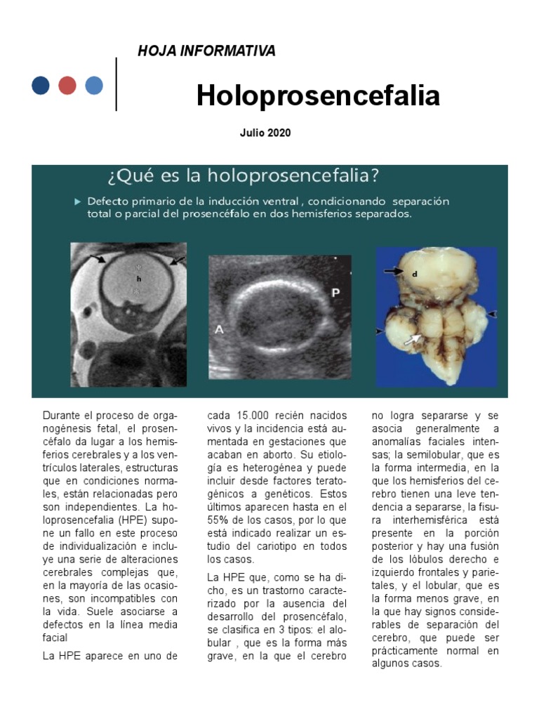 Holoprosencefalia | PDF | Enfermedades y trastornos humanos | Biología