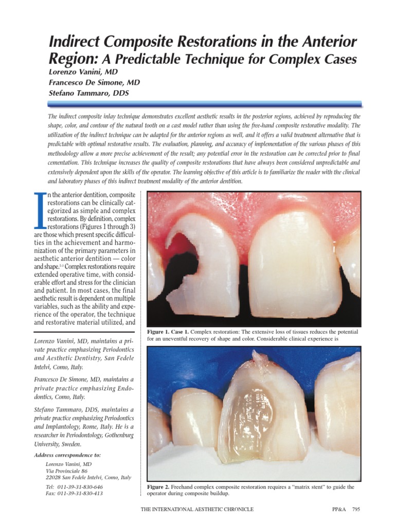 Indirect Composite Restorations in The Anterior Region:: A Predictable ...