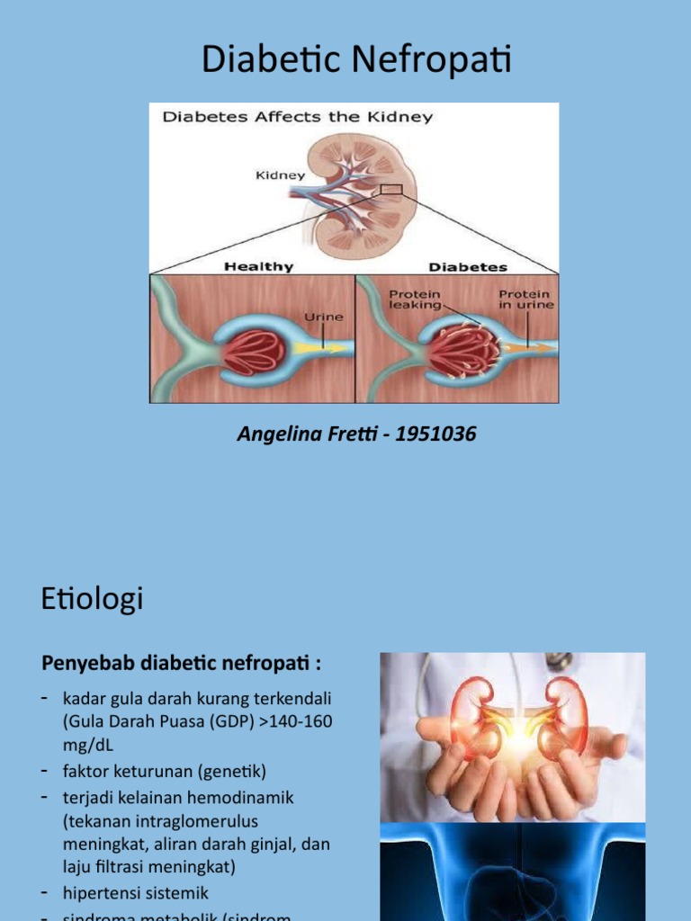 Penyebab dan Dampak Diabetic Nefropati | PDF