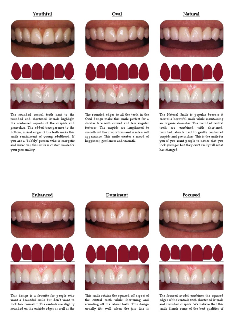 Veneer Shapes | Download Free PDF | Tooth | Dentistry Branches