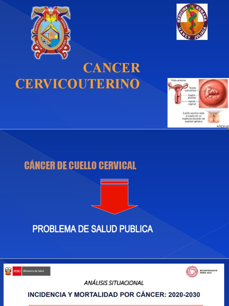 Ca Cervicouterino | PDF | Cáncer de cuello uterino | Cáncer